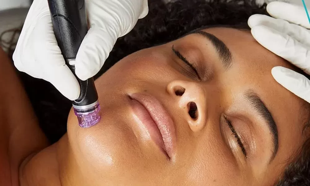 Intensive Facial Therapy with ProfiDerm Professional by NOON Aesthetics ...